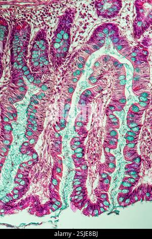 Small intestine with intestinal villi under the microscope 200x Stock ...