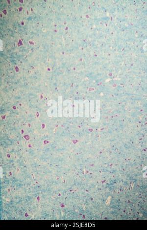 Nerve cells under the microscope 100x Stock Photo - Alamy
