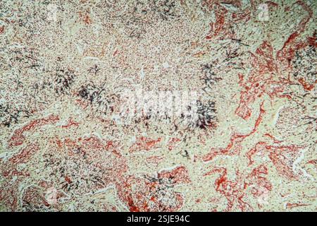 Lung tissue under the microscope 100x Stock Photo - Alamy