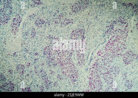 Tissue infected by bacteria under the microscope 200x Stock Photo - Alamy