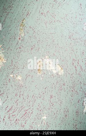 Lung tissue under the microscope 100x Stock Photo - Alamy