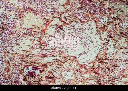 Lung tissue under the microscope 200x Stock Photo - Alamy