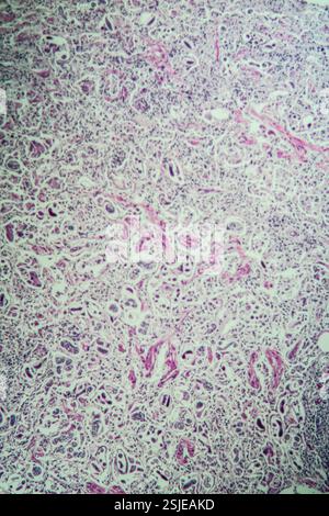 Lungworm under the microscope 100x Stock Photo - Alamy