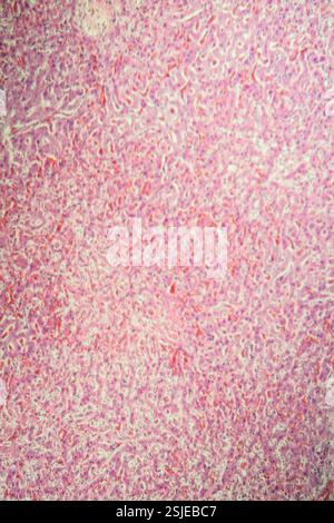 Hedgehog kidney after shock Tissue under the microscope 100x Stock ...