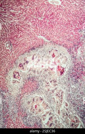 Parasite eggs in tissue 100x Stock Photo - Alamy