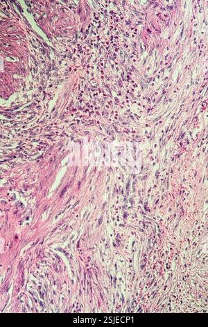 Gallbladder tissue under the microscope 200x Stock Photo - Alamy