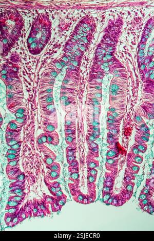 Small intestine with intestinal villi under the microscope 100x Stock ...