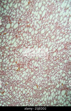 Healthy lung tissue under the microscope 100x Stock Photo - Alamy