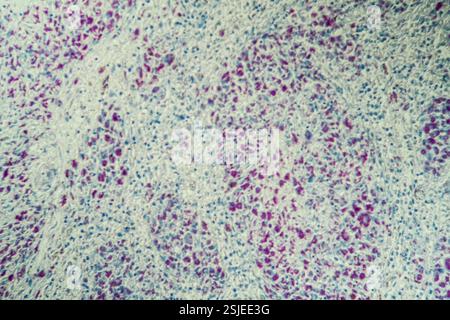 Tissue infected by bacteria under the microscope 100x Stock Photo - Alamy