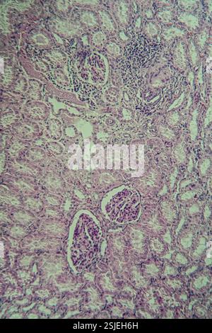 Cross section of the kidney with renal corpuscles 100x Stock Photo - Alamy