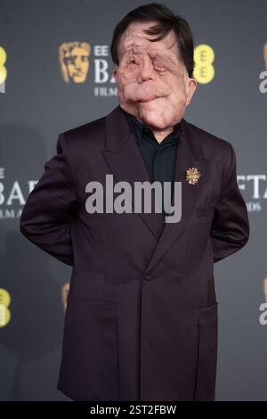 16/02//2025. London, UK Adam Pearson attends the EE BAFTA British ...