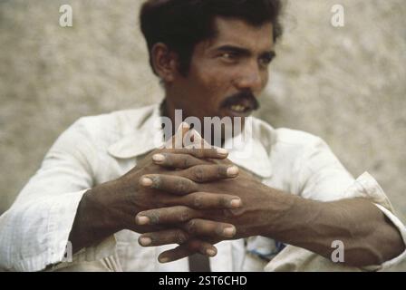 Man with six fingers to hand, india Stock Photo - Alamy