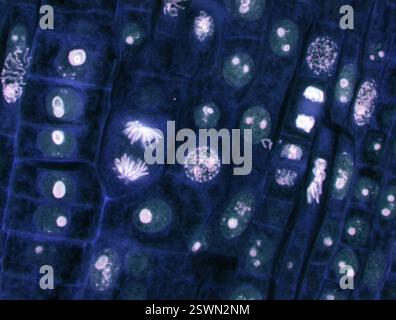 Plant cell mitosis. Light micrograph of root tip cells from an onion ...