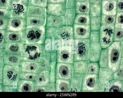 Plant cell mitosis. Light micrograph of root tip cells from an onion ...