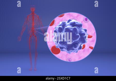 Parvovirus B19 in erythema infectiosum - section view 3d illustration ...