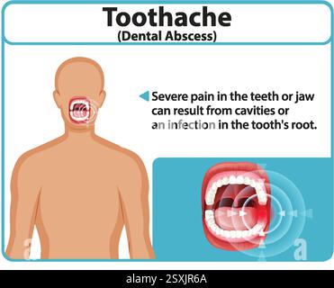 Illustration of toothache causes and symptoms Stock Vector Image & Art ...