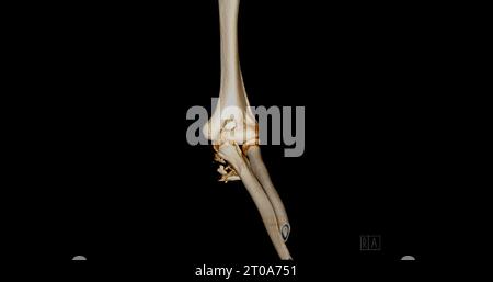 CT scan of elbow joint 3d rendering Stock Photo - Alamy