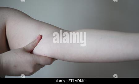 Light-skinned young woman with drooping arms. Sad bad body shape girl ...