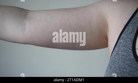 Light-skinned young woman with drooping arms. Sad bad body shape girl ...