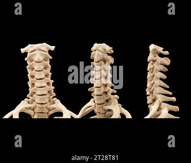 CT scan of C-Spine or Cervical spine 3D rendering for diagnosis ...