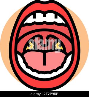 swollen tonsils disease symptom color icon vector illustration Stock ...