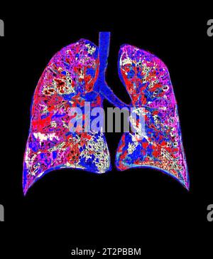 False-colour computed tomography (CT) X-ray scan through the human ...
