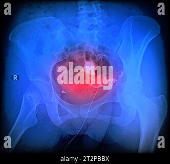 Uterus Female Reproductive Anatomy. Healthy Uterine Gynecology Stock ...