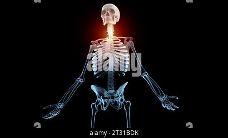 x-ray skeleton with chest and neck pain Stock Photo - Alamy