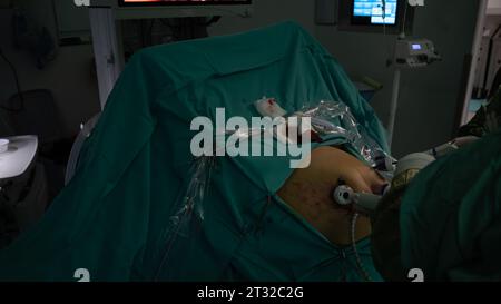 Obesity surgery. Weight loss surgery is performed with laparoscopic ...