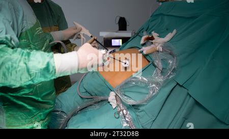 Obesity surgery. Weight loss surgery is performed with laparoscopic ...