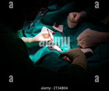 Close-up of a surgeon's hands stitching a patient's skin incision Stock ...