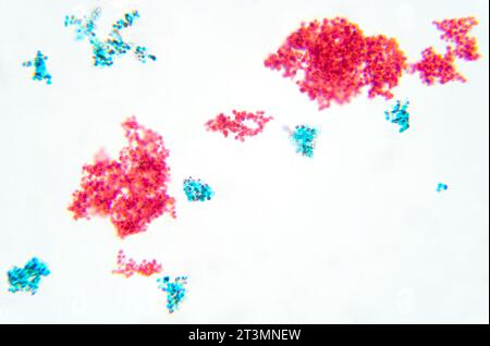 Yeast cells. Light micrograph of cells of brewer's or baker's yeast ...