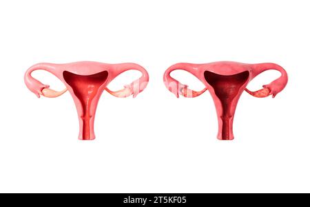 Human uterus model, 3d rendering. 3d illustration Stock Photo - Alamy
