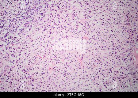 Photomicrograph of malignant cells, revealing abnormal and uncontrolled ...