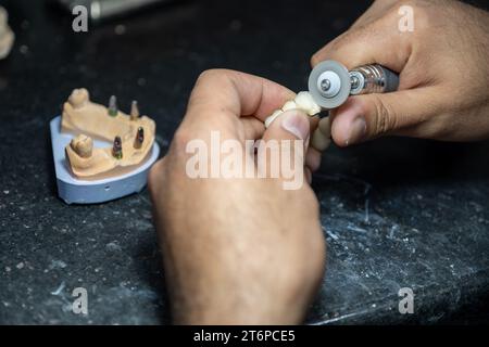 sawing dental crowns to fit during occlusion inside the human mouth ...