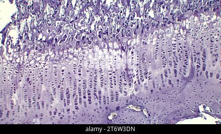 Development of bone in the place of the cartilage model. The growth ...