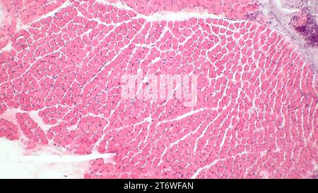 Light micrograph of a section through skeletal muscle. Muscle fibre ...