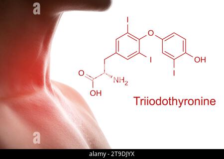 Female neck and triiodothyronine hormone formula produced by thyroid ...