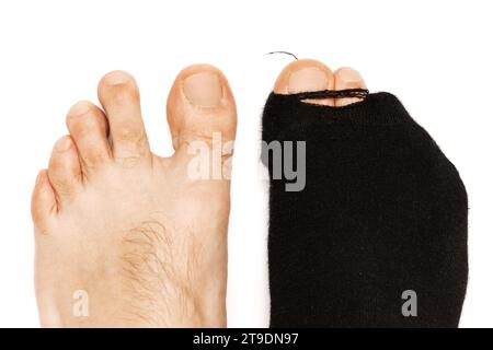 Closeup shot of male feet with a toe sticking out from a single hoaly ...