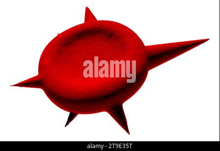 Spur cell. Illustration of an abnormal red blood cell known as a spur ...