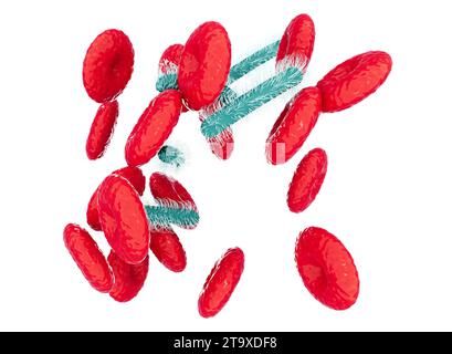 Sepsis is a potentially life-threatening condition caused by the body's ...