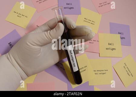 Kell antigen concept. Notes with questions about Kell antigen and 4 ...