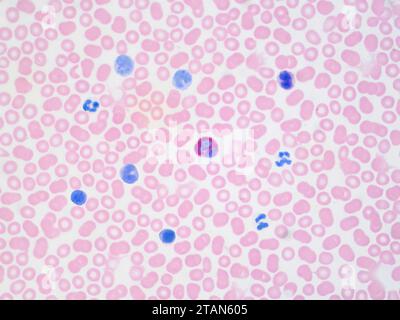 light micrograph of normal human blood cells Stock Photo - Alamy