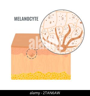 Skin pigmentation, conceptual illustration Stock Photo - Alamy