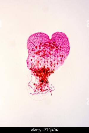 Fern prothallus or prothallium with rhizoids. Optical microscope X40 ...