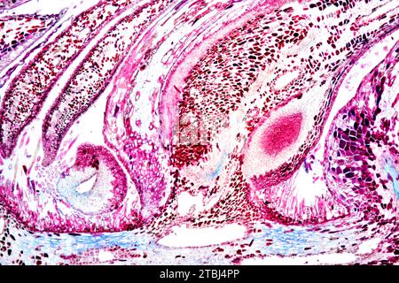 Female cone of european larch (Larix decidua), showing ovules. Optical ...