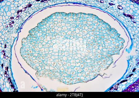 Female cone of pine (Pinus sp.) showing embryo and endosperm. Optical ...