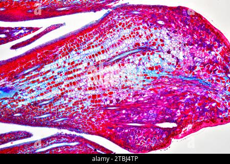 Female cone of pine (Pinus sp.) showing embryo and endosperm. Optical ...