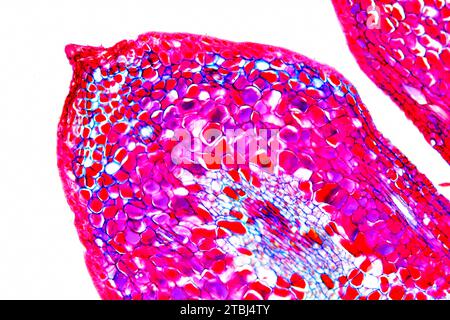 Female cone of pine (Pinus sp.) showing embryo and endosperm. Optical ...