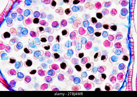 Male cone of pine (Pinus sp.) showing pollen. Optical microscope X100 ...